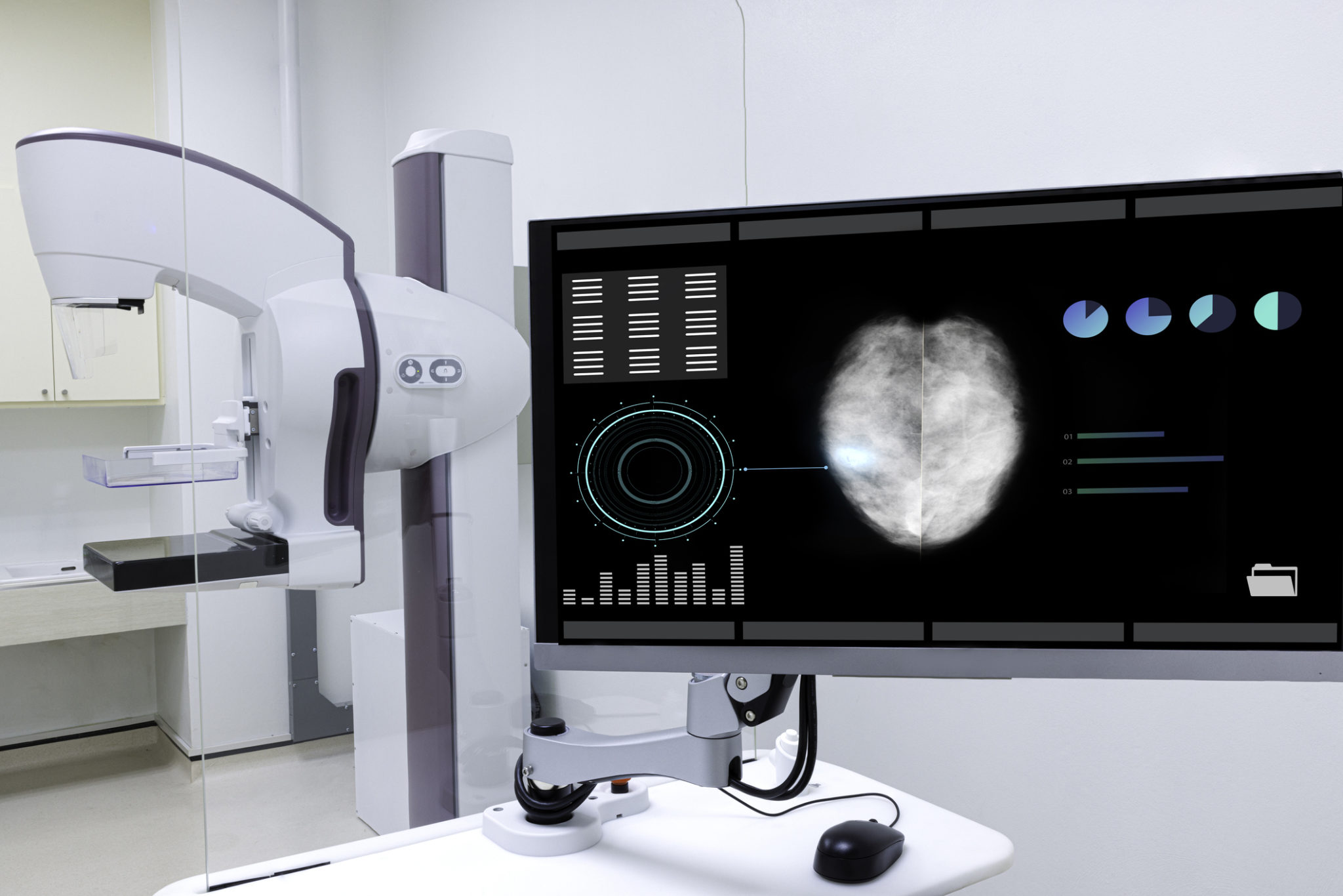 New Mobile Mammography Unit Brings More Access to Southeastern NC ...