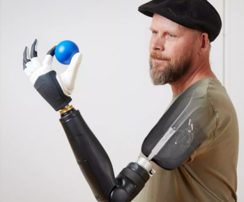 New Bionic Hand Allows User to Control Each Finger With Unprecedented ...