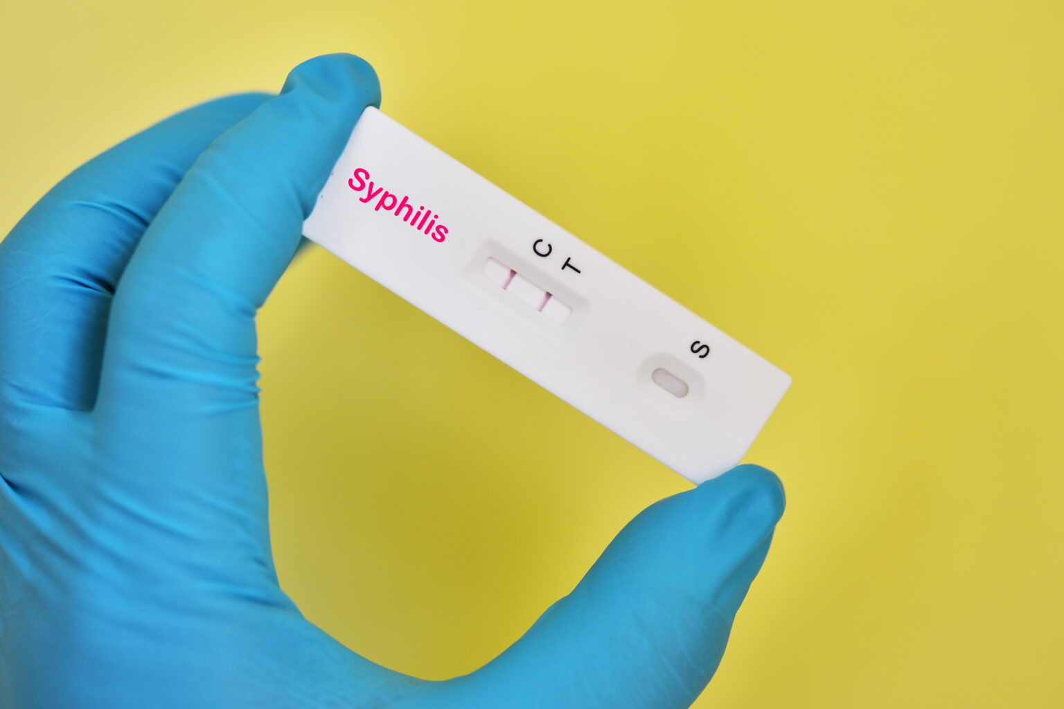 Doctors Call to Expand Syphilis Testing during Pregnancy Amid Recent ... Doctors Call to Expand Syphilis Testing during Pregnancy Amid Recent ...