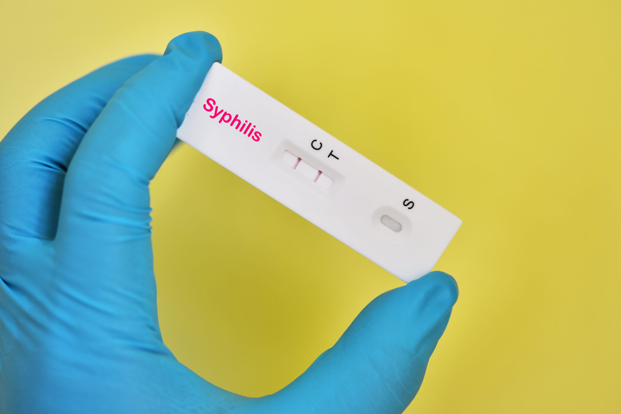 Reminder: Missed Opportunities for Preventing Congenital Syphilis ...