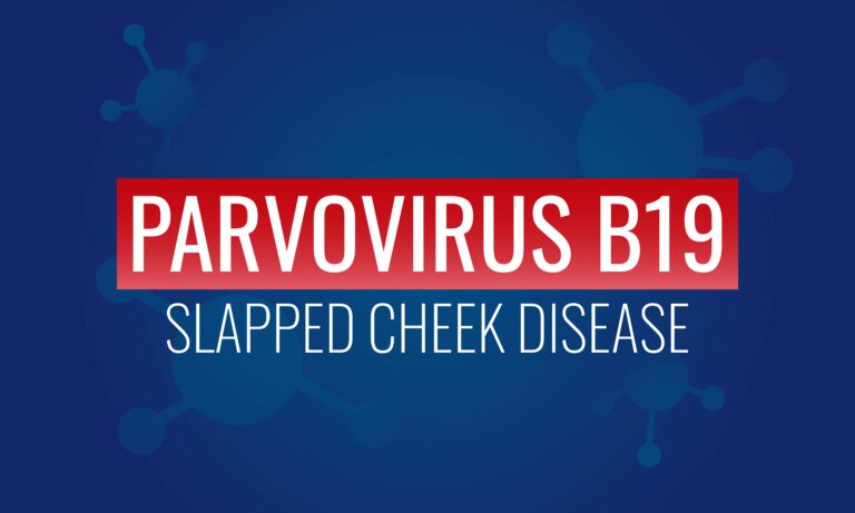 Parvovirus B19 Rising in the US, Particularly Among Children. Poses ...