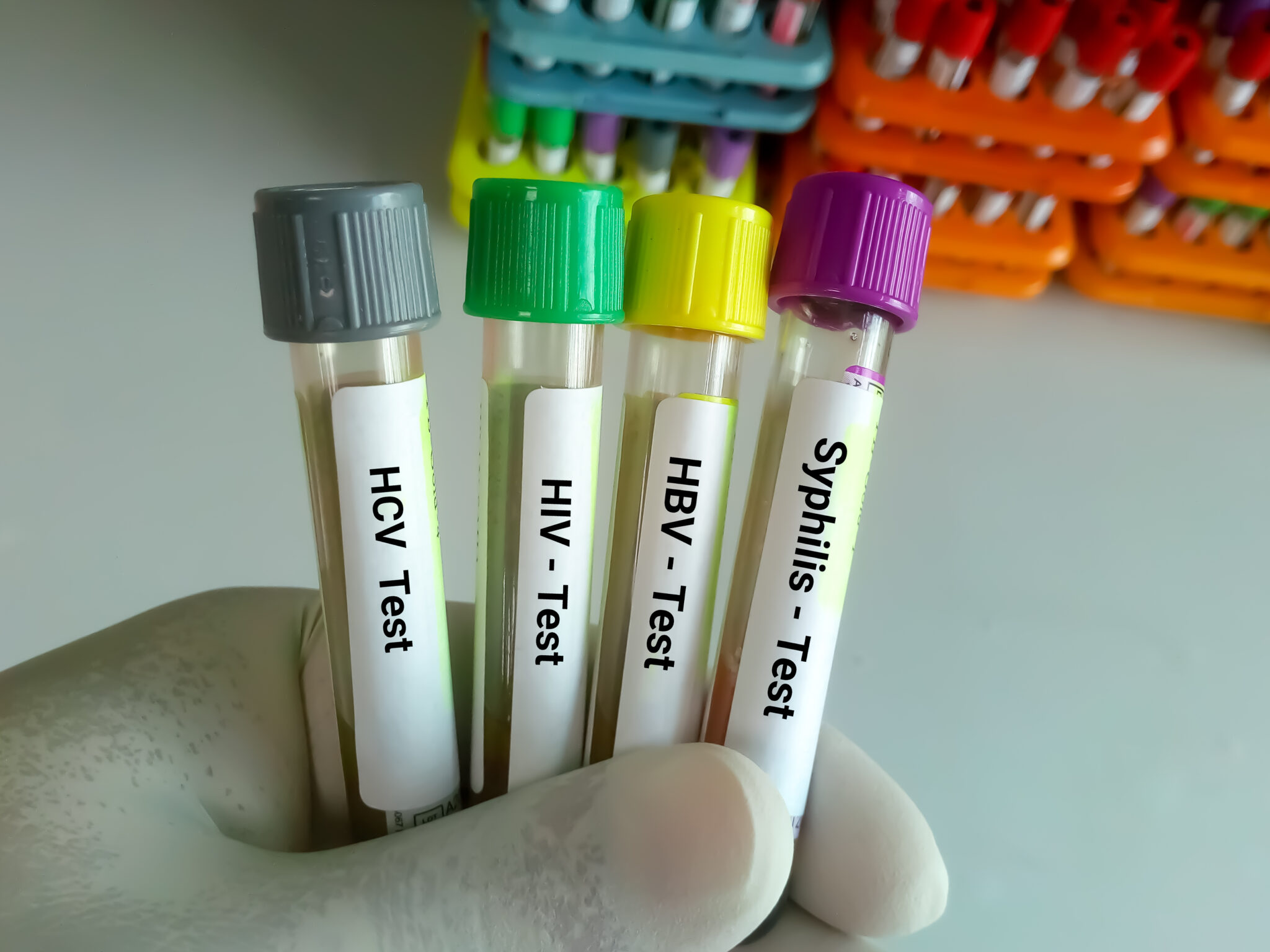 3 NC Cities Among Highest in Country for STD Rates - North Carolina ...